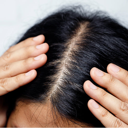 Hair Exfoliation – KT Professional